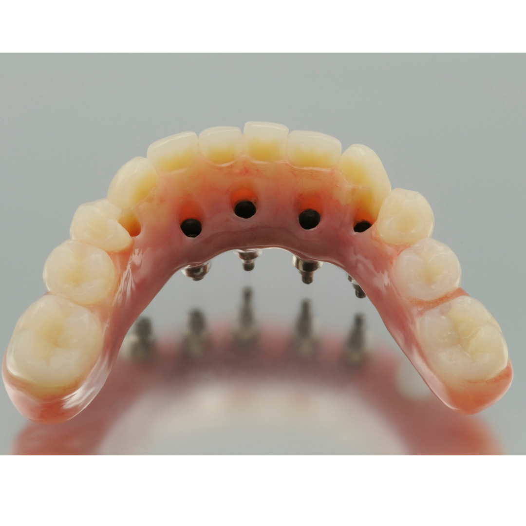 Denture Options - Pasha Dental Group